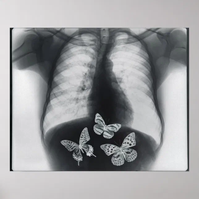 Póster Rayos X de mariposas en el estómago | Zazzle.es