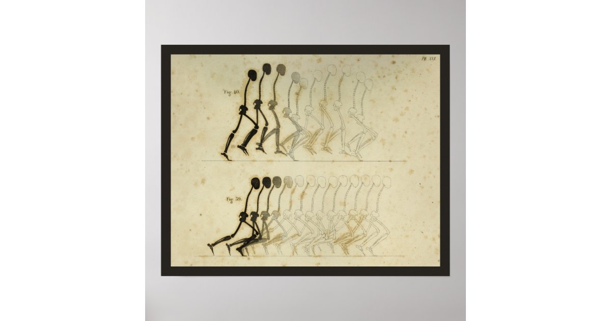 Póster Walking Gait Analysis Leg Spine Chiropractic Chart | Zazzle.es